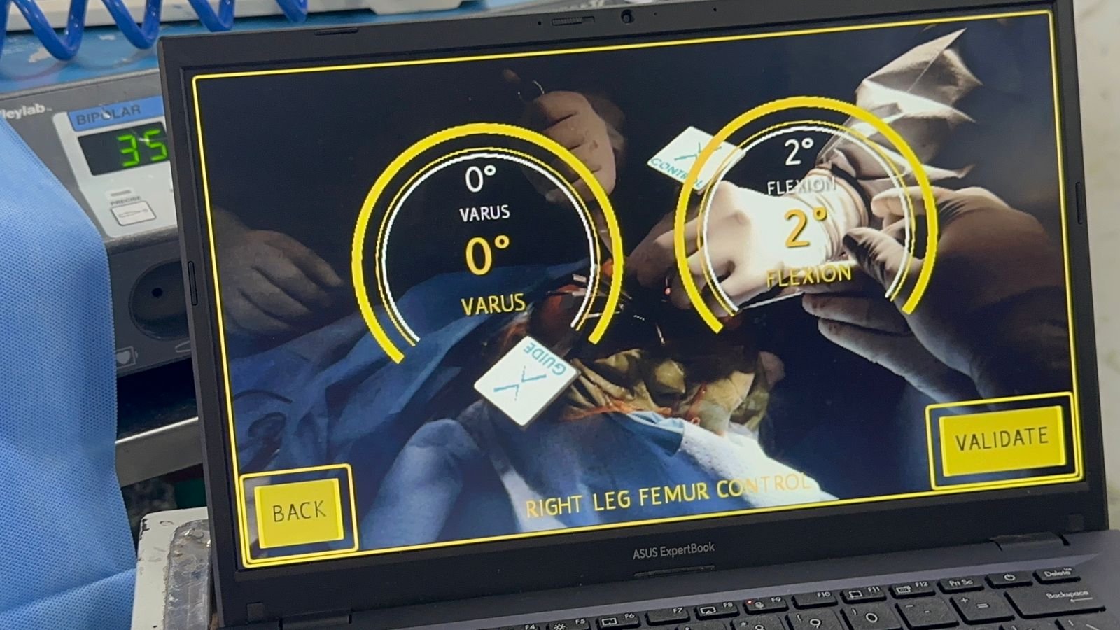 Dr Sunil Kini - Specialist Hip and Knee Surgeon